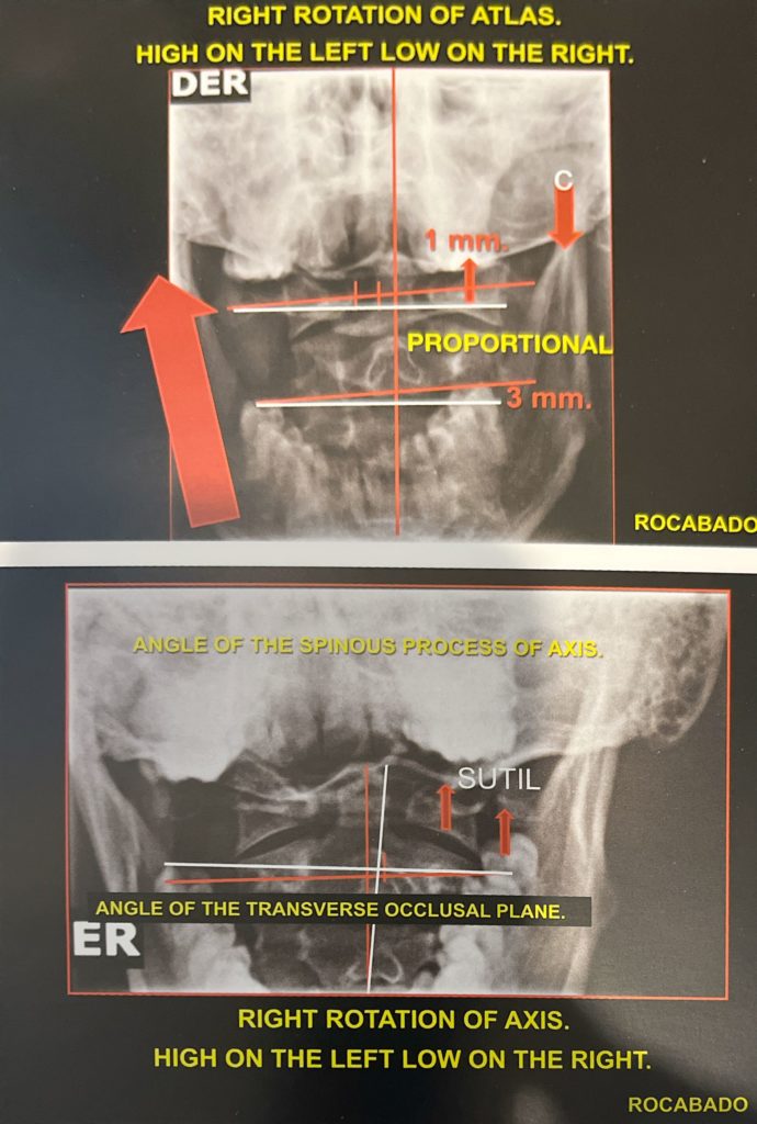 Mariano Rocabado Trained TMJ Therapist - FuncPhysio Physical Therapy