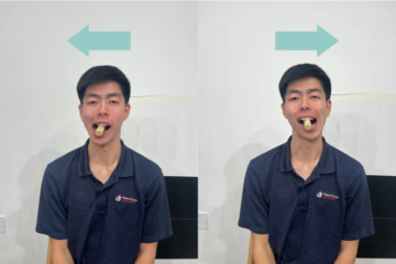 Jaw Pain - FuncPhysio Physical Therapy