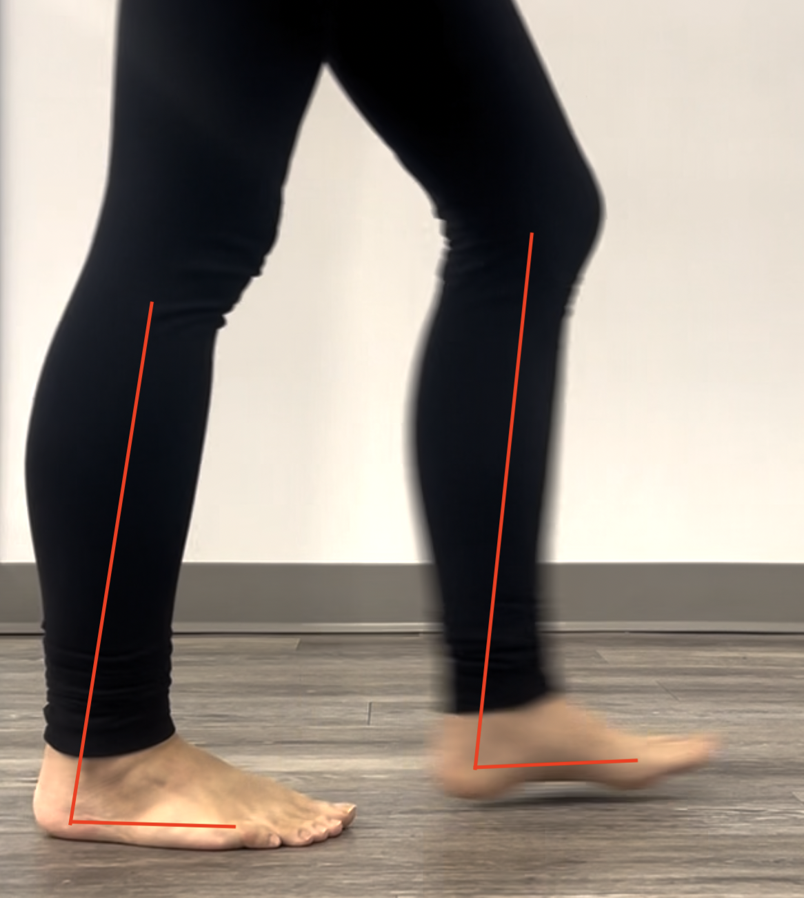 Ankle Equinus - how stiff ankles affect the entire body - FuncPhysio ...