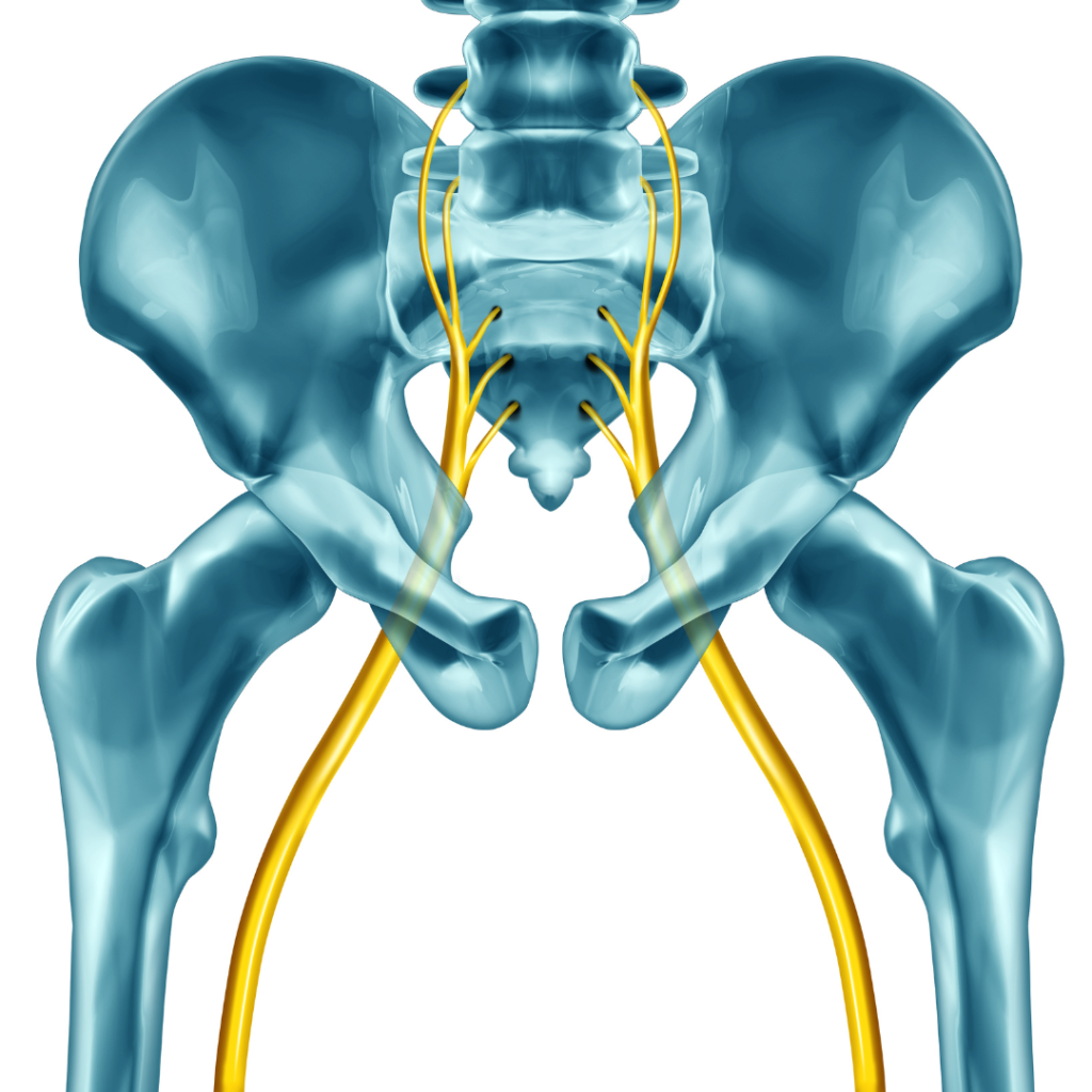 Sciatica: Understanding Its Causes and Symptoms - FuncPhysio Physical ...